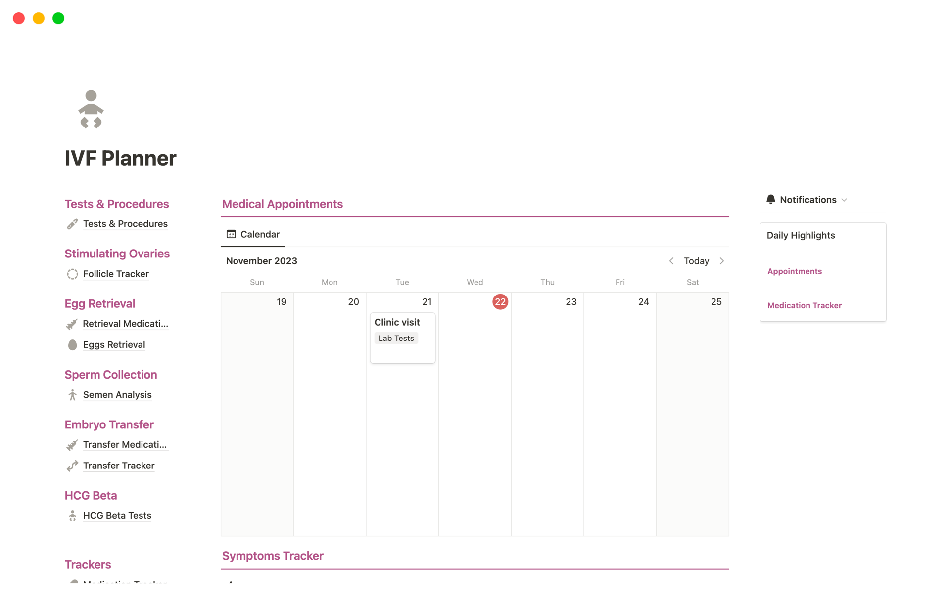 Second Brain | Notion Template